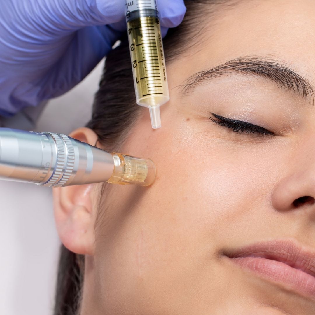 Revitalize Your Skin with a Rejuvenating Plasma Facial Treatment